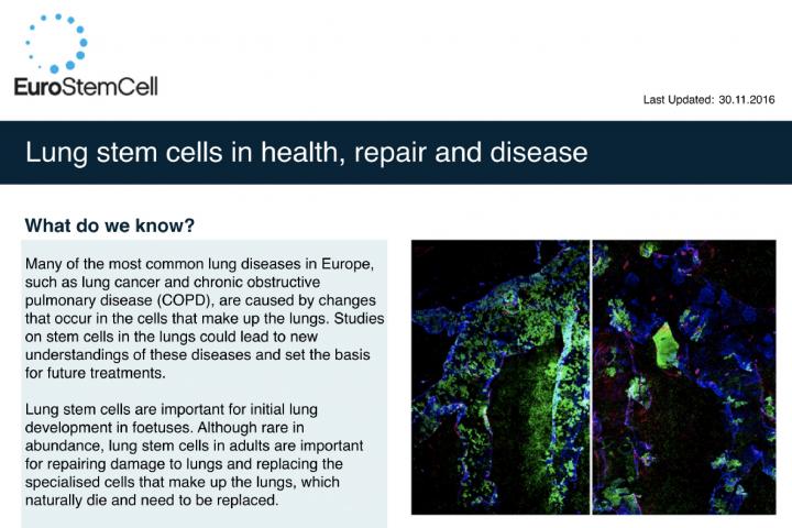 Lung stem cells in health, repair and disease | Eurostemcell